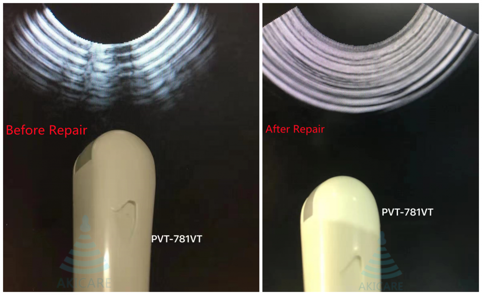 PVT-781VT For Toshiba Aplio MX Endocavity TransVaginal Transducer ...